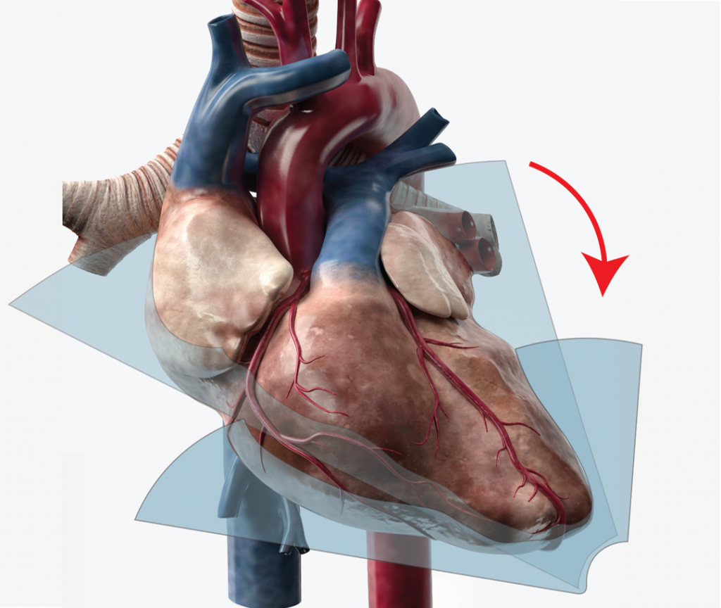 Discovering the aorta through ultrasound - Critical Care Sonography