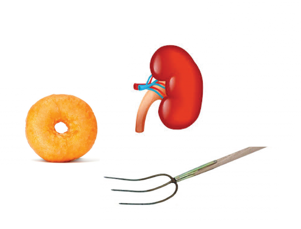 Intussusception: Left upper quadrant mass - Critical Care Sonography
