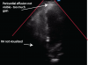 ECHO : image optimisation - Critical Care Sonography