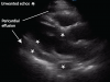 ECHO : image optimisation - Critical Care Sonography