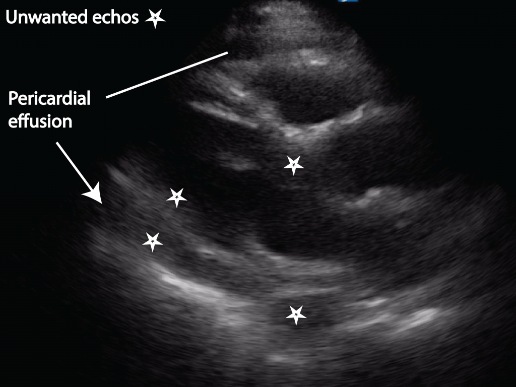 ECHO : image optimisation - Critical Care Sonography