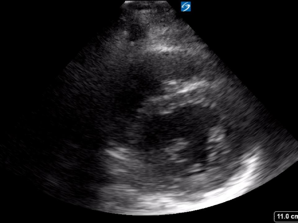 ECHO : image optimisation - Critical Care Sonography