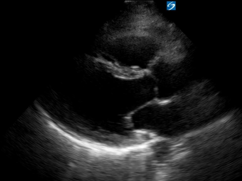 ECHO : image optimisation - Critical Care Sonography