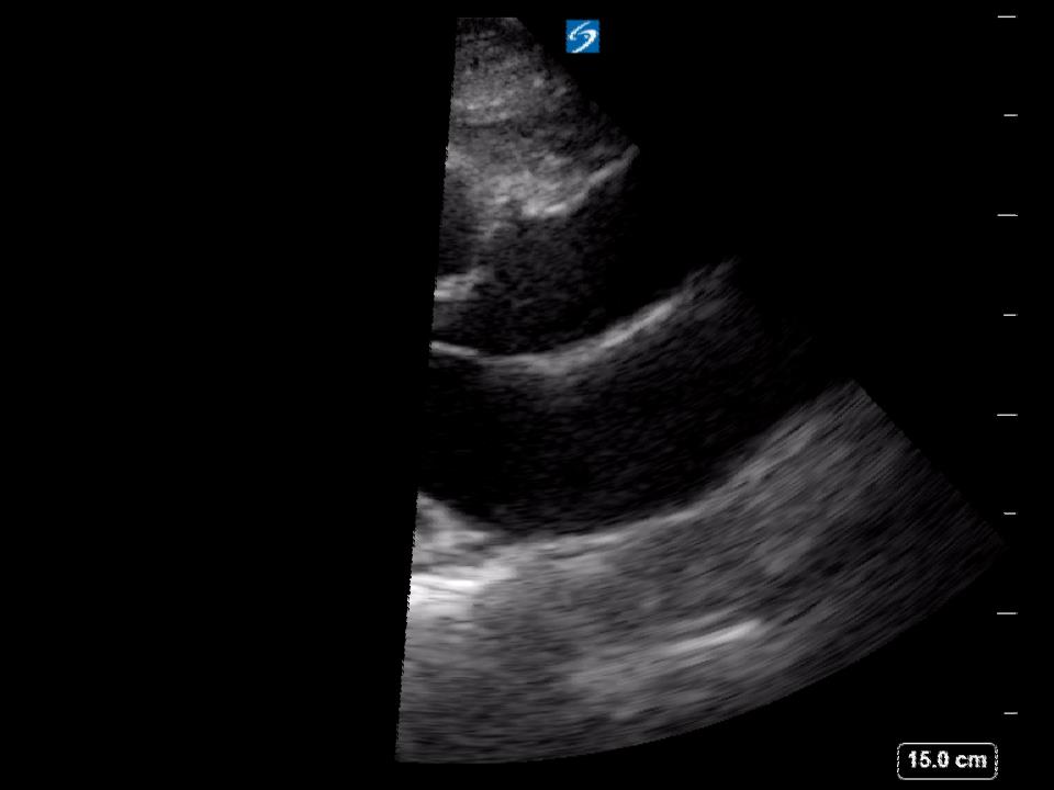 ECHO : image optimisation - Critical Care Sonography