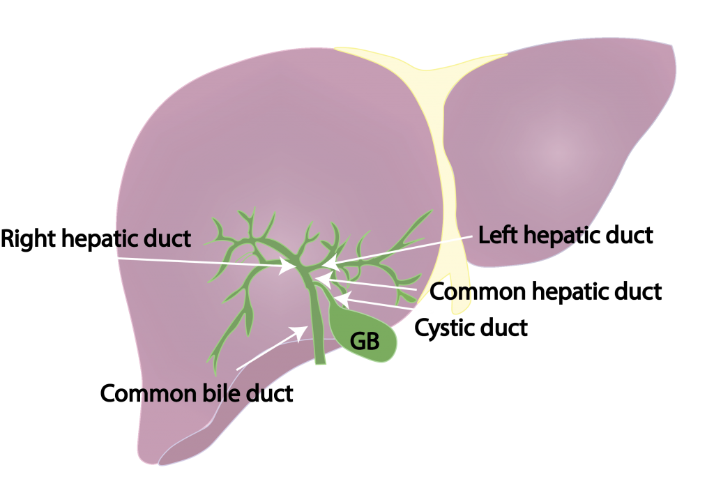 Biliary Obstruction: Double Barrel sign, Monkey Puzzle sign - Critical ...