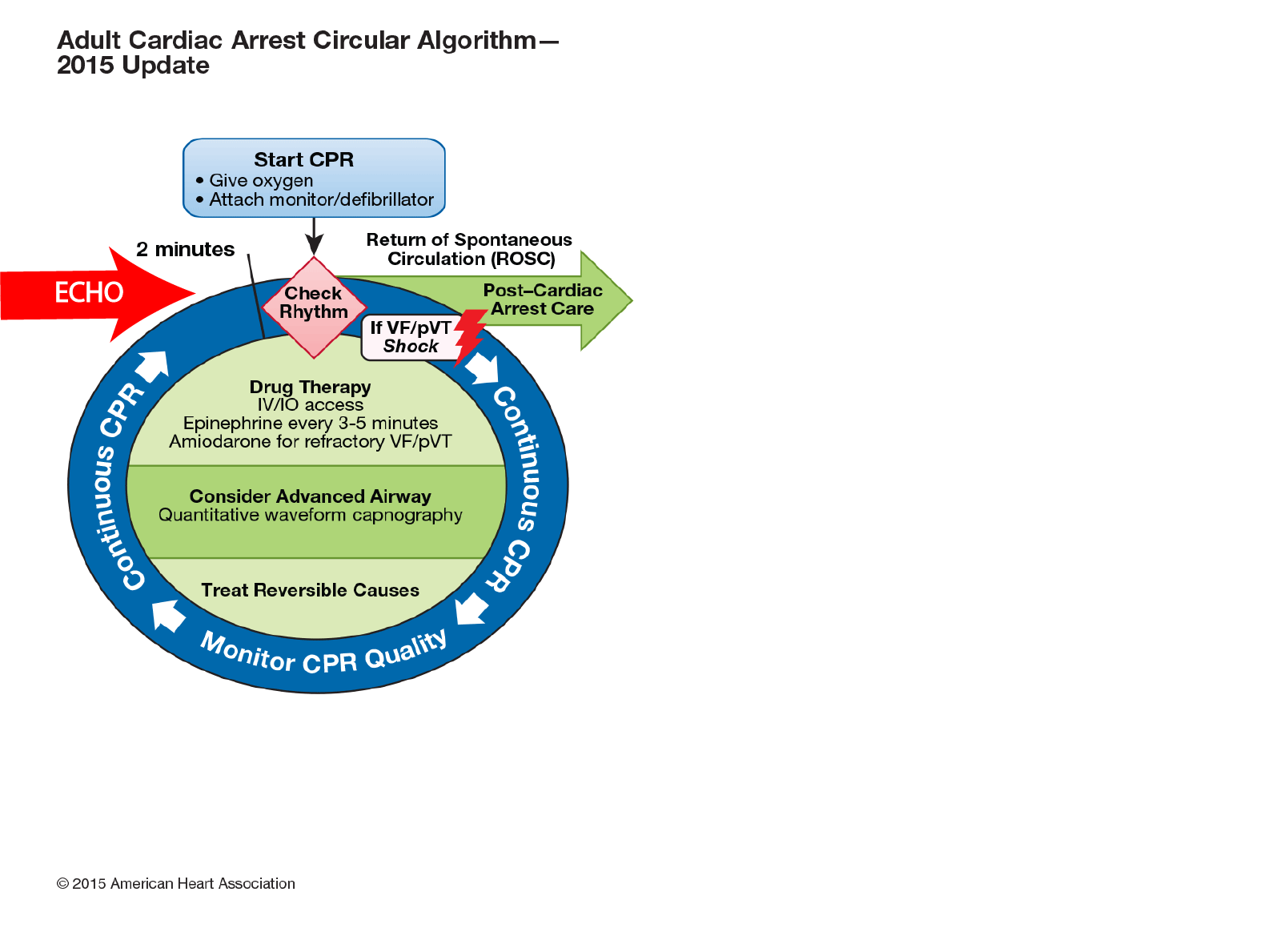 Question 10: Ultrasound in cardiac arrest - Critical Care Sonography