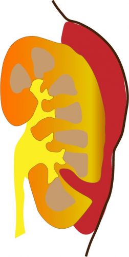 Trauma: Right kidney laceration - Critical Care Sonography