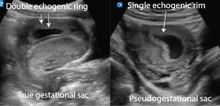 - Page 3 of 23 - Critical Care Sonography