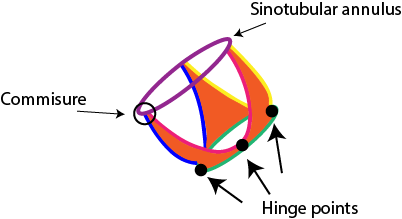 Aortic valve anatomy - Critical Care Sonography