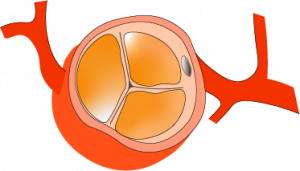 Aortic valve anatomy - Critical Care Sonography