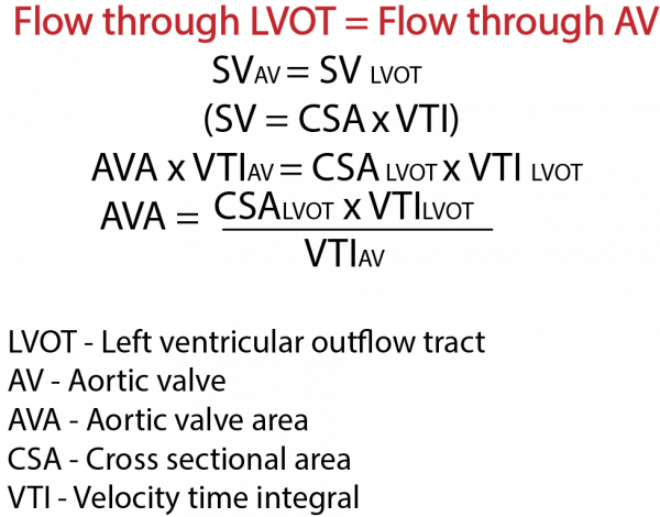 2. Assessment of Severity of AS : Quantitative assessment - Critical ...