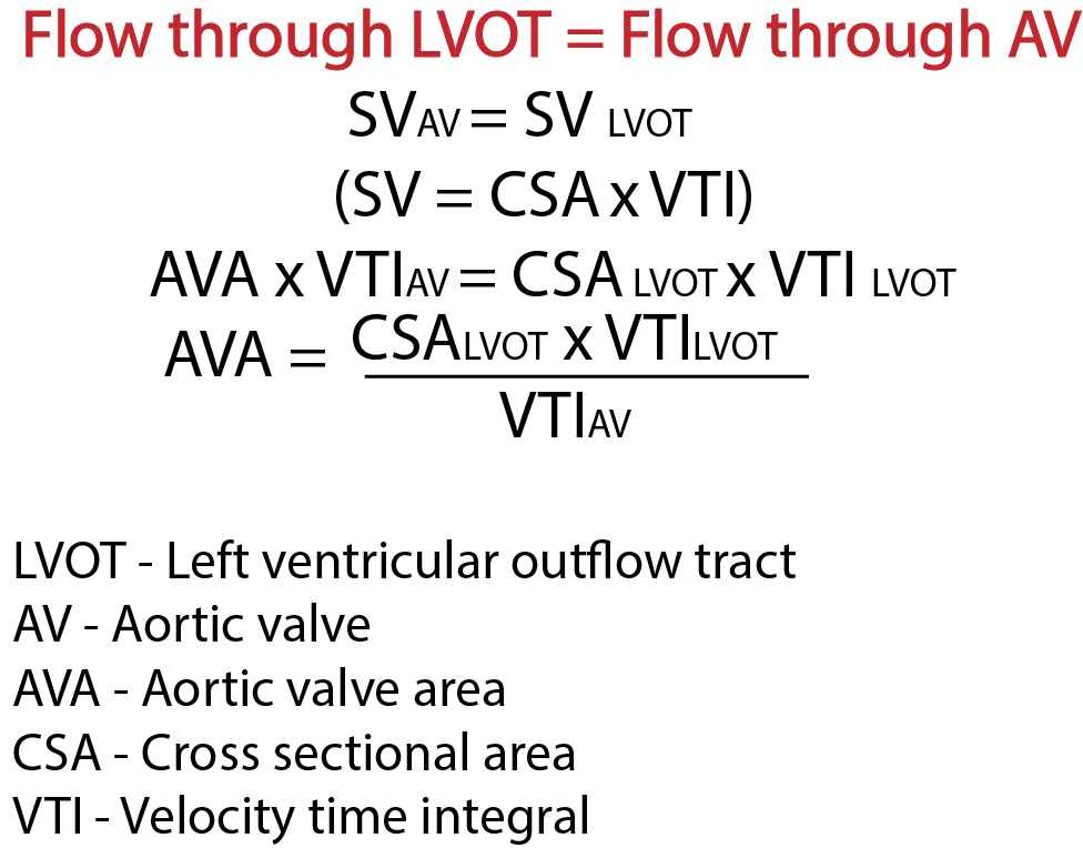 2. Assessment of Severity of AS : Quantitative assessment - Critical ...