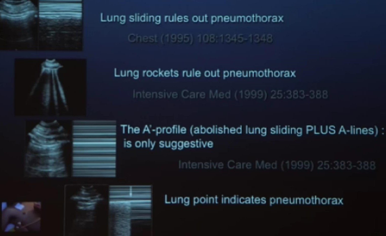 Lung Ultrasound by Dr Lichtenstein - Critical Care Sonography