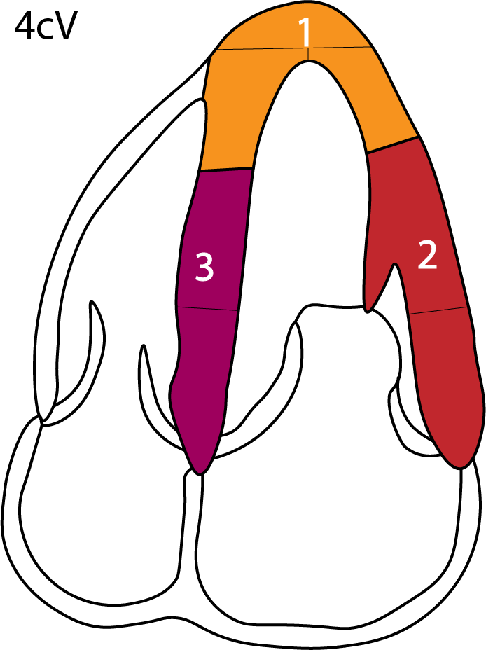 Assessment of the LV Quiz - Critical Care Sonography