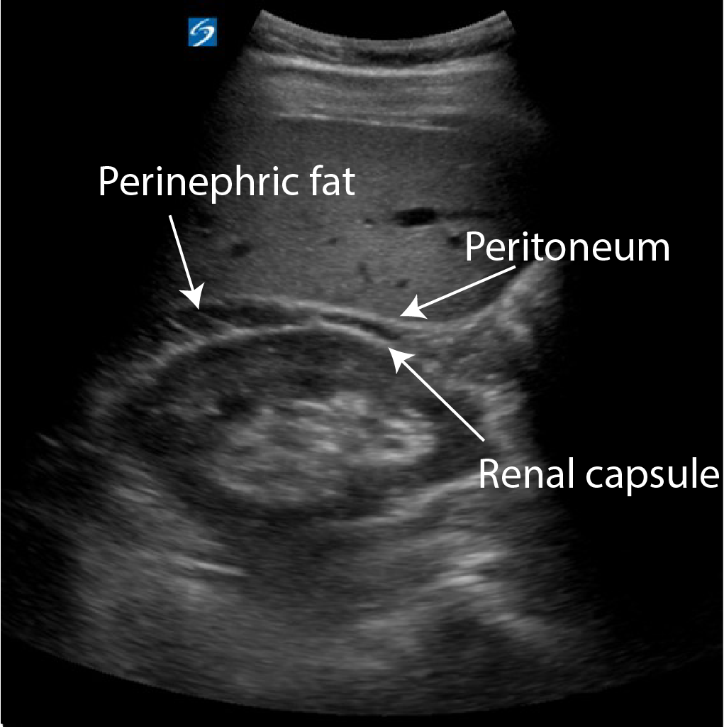 EFAST quiz - Critical Care Sonography
