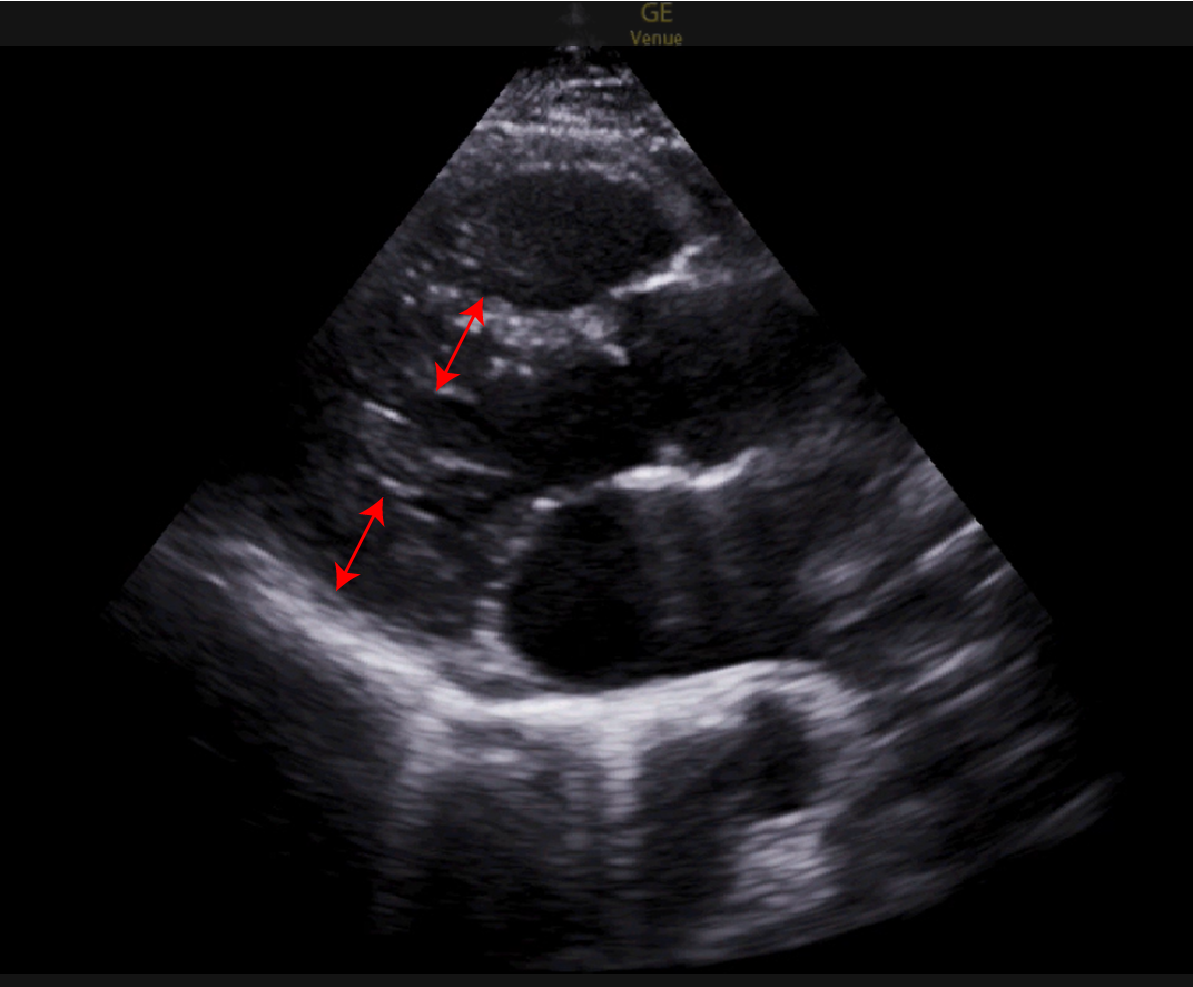 8. Case of the month: Assessment of LV function - Critical Care Sonography