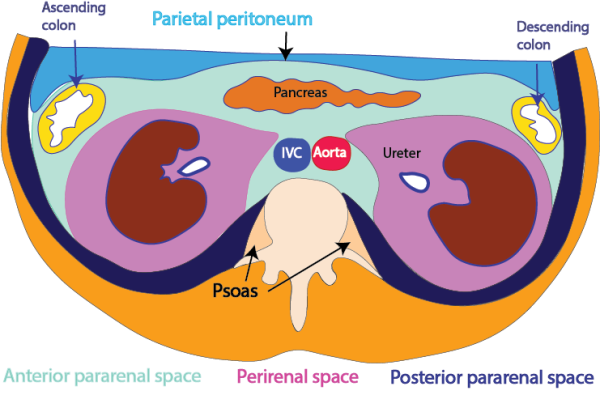 11. Case of the month: Right hip pain - Critical Care Sonography