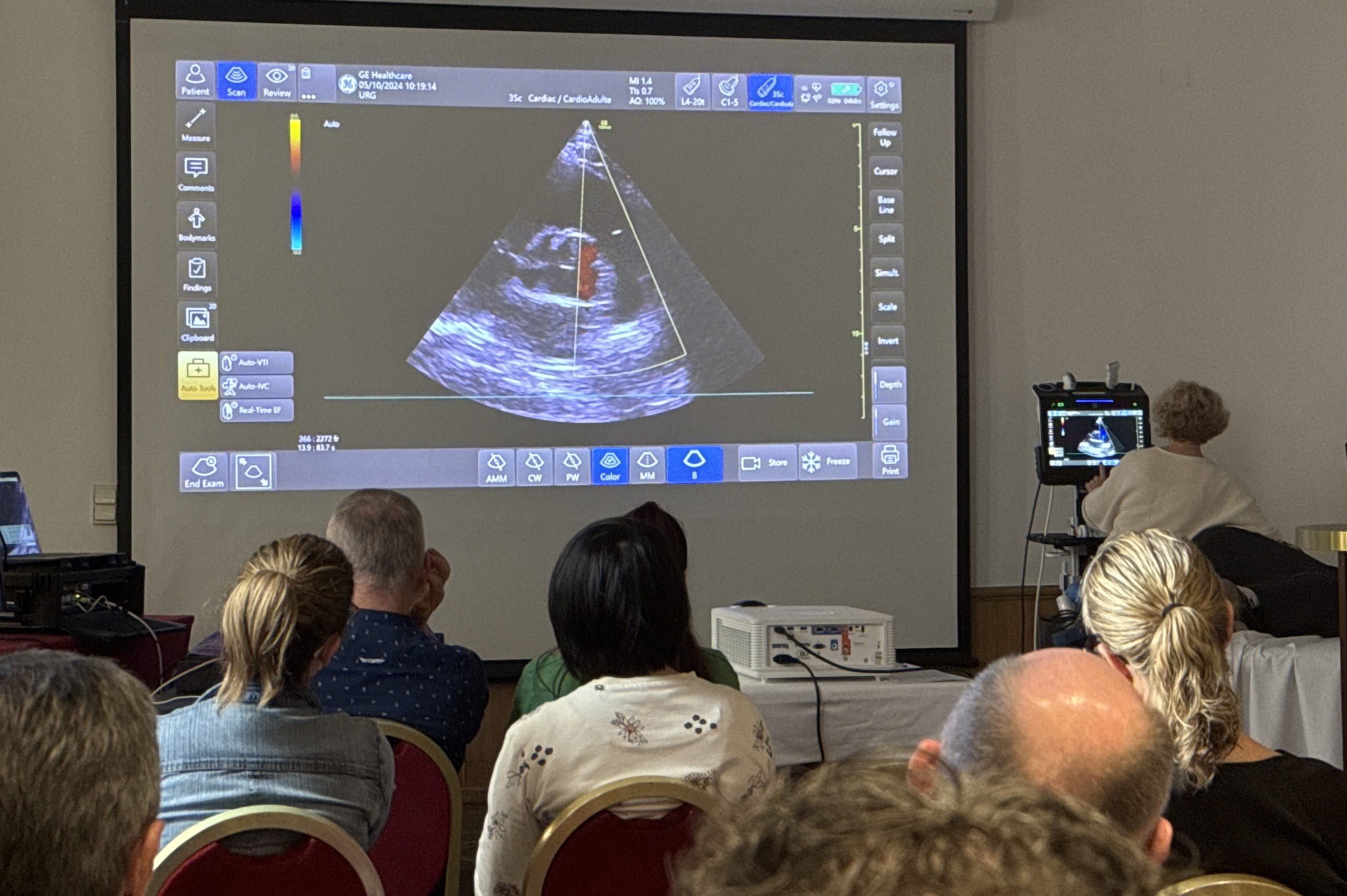 POCUS Workshop - Nice, France - Critical Care Sonography